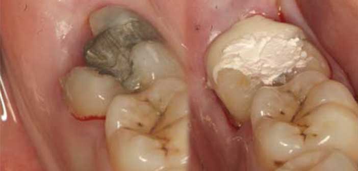 Le plateau technique en endodontie Le plateau technique en endodontie