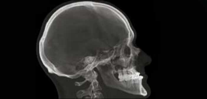 Radiologie conventionnelle et scanner en implantologie