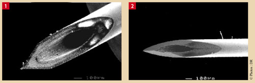 L’aiguille fait sa révolution - LEFILDENTAIRE magazine dentaire