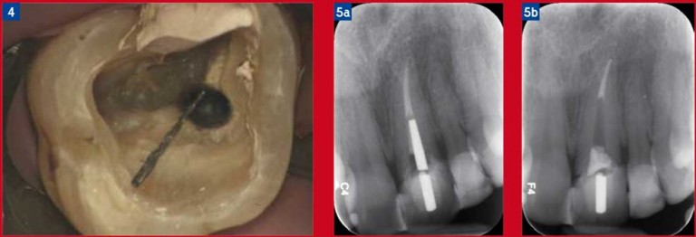 Le plateau technique en endodontie Le plateau technique en endodontie