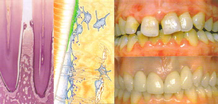 Parodontie médicale