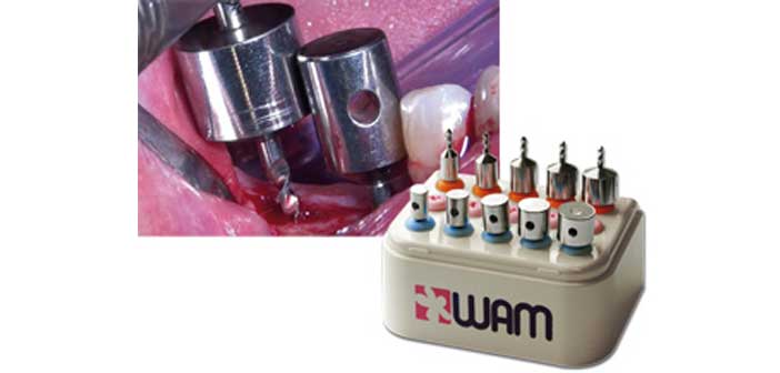 WAM MD Guide : Visez juste ...Forez juste