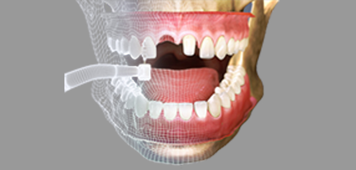 LE DENTAL EXPert Pro 3D