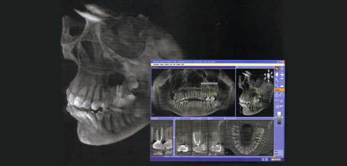Cone BEAM imagerie dentaire et maxillofaciale