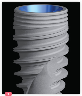 Extraction implantation et provisoire immédiates
