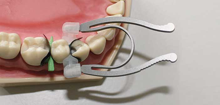 Myclip le porte-matrice intelligent