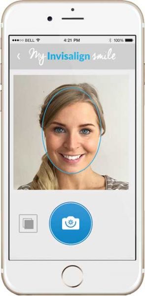 My invisalign APP