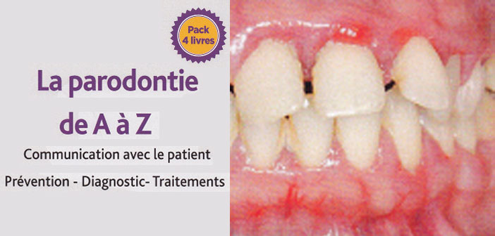 La parodontie de A à Z