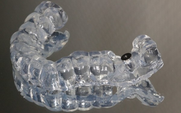 La chirurgie guidée implantaire : du « all-inclusive » au « self-service