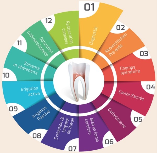 Les 3 étapes d’un traitement endodontique réussi