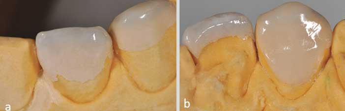 Des dentelles de céramique
