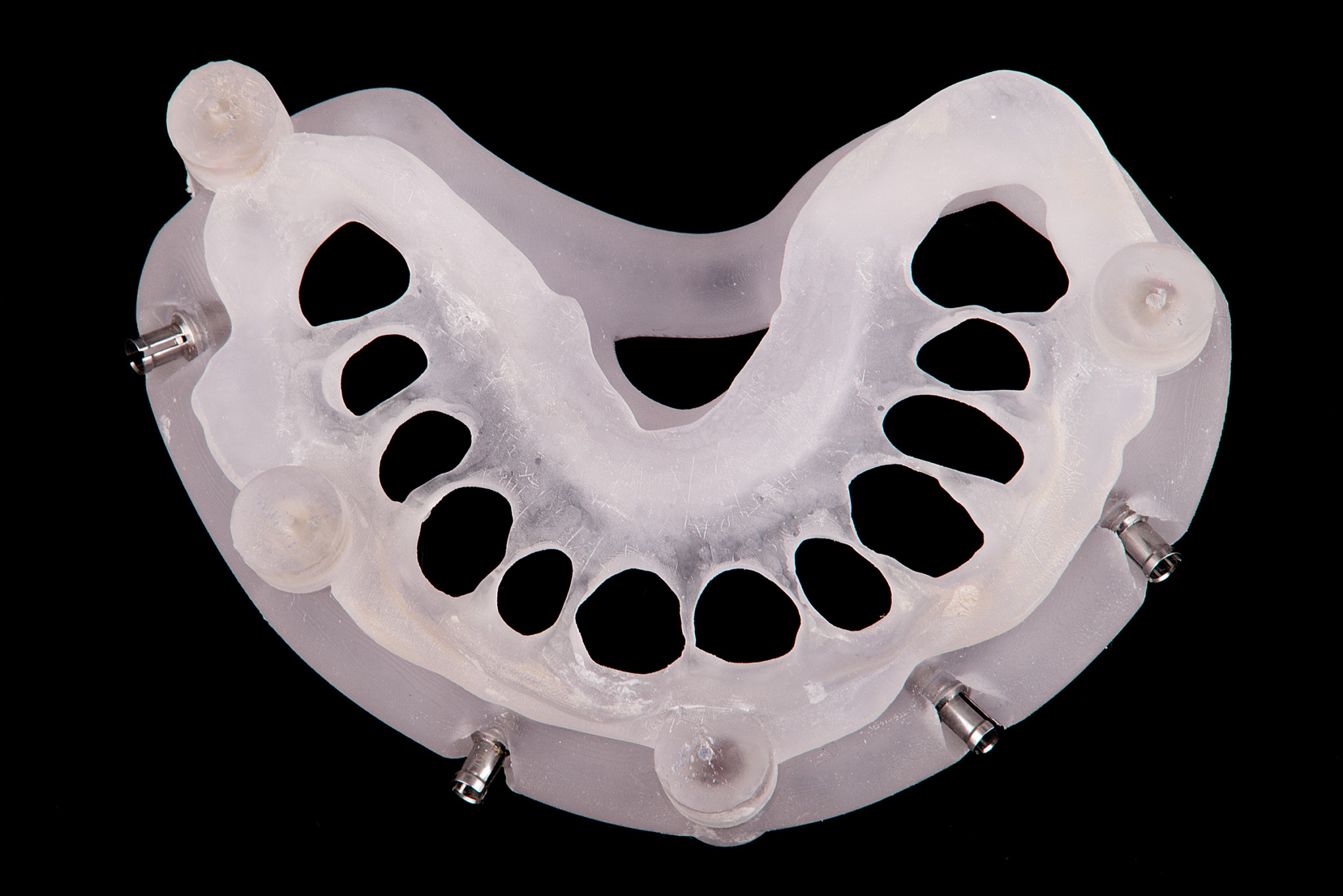 GUIDE À ÉTAGE : OÙ EN EST-ON ? - LEFILDENTAIRE magazine dentaire