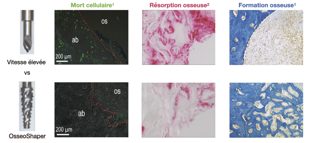 UN SYSTÈME IMPLANTAIRE AU DÉFI DE LA ZONE ESTHÉTIQUE, N1® DE NOBEL ...