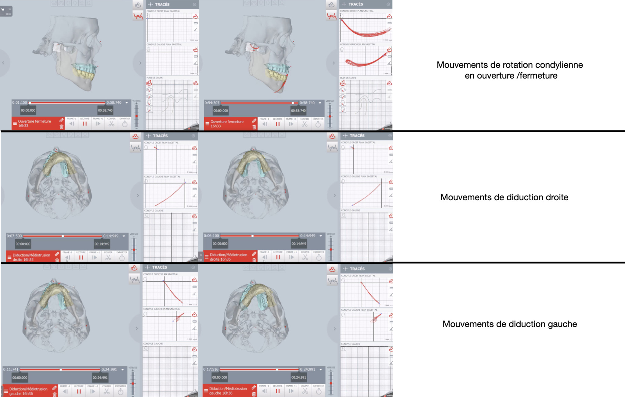 APPORT DU DISPOSITIF MOJDAW® DANS LA PLANIFICATION NUMÉRIQUE DE ...