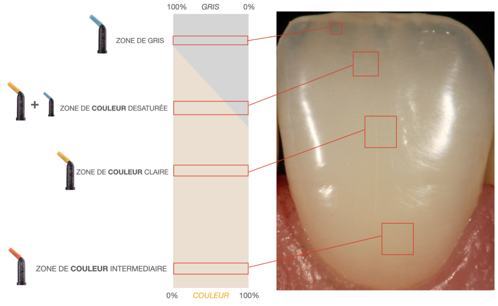 STRATIFICATION DES COMPOSITES EN ANTÉRIEUR : SIMPLIFICATION ET NOUVEAUX ...