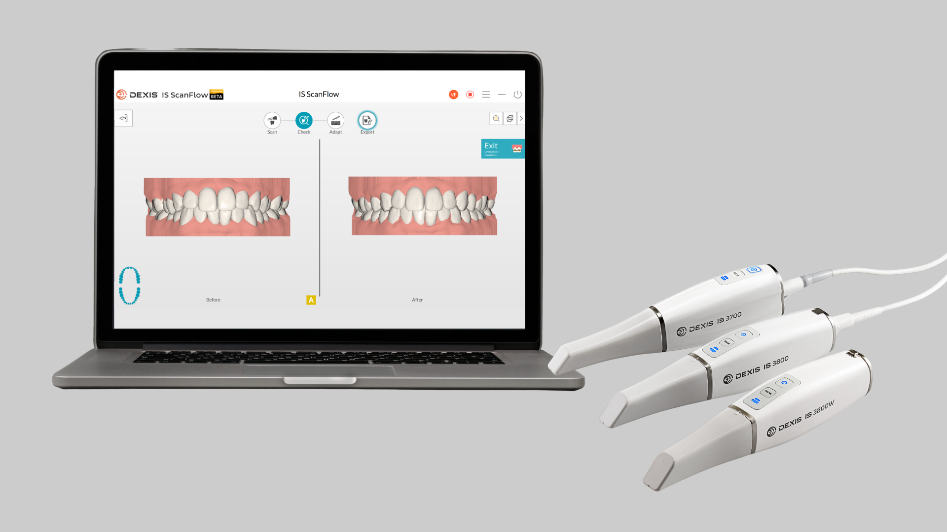 DEXIS™ IOS SOLUTIONS ÉLARGIT SON PORTEFEUILLE ET SON ÉCOSYSTÈME ...