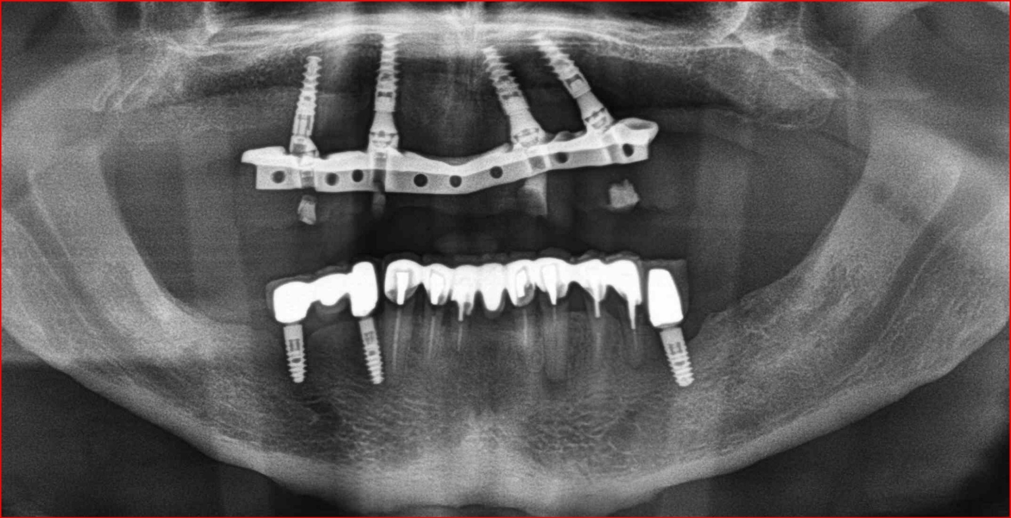 CONE BEAM (CBCT) EN IMAGERIE DENTO-MAXILLAIRE COMMENT CHOISIR UN ...