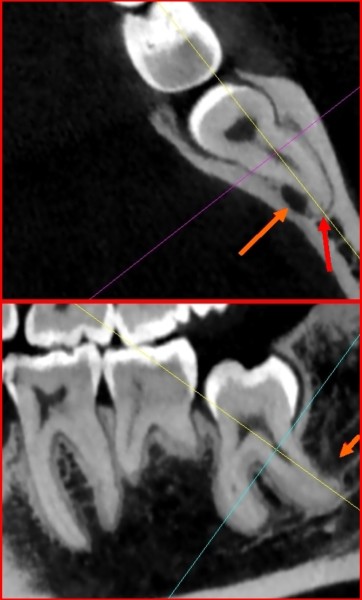 CONE BEAM (CBCT) EN IMAGERIE DENTO-MAXILLAIRE COMMENT CHOISIR UN ...