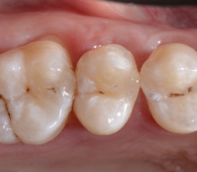 LEFILDENTAIRE magazine gratuit de la presse dentaire