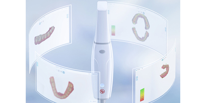 SMILE SCAN LA PRISE D’EMPREINTE NUMÉRIQUE N’A JAMAIS ÉTÉ AUSSI RAPIDE ...