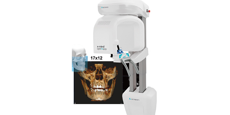 X-MIND OPTIMA 3D Intelligent, Compact, Révolutionnaire - LEFILDENTAIRE magazine dentaire
